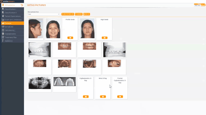 How to Easily Navigate Your Orthodontic Treatment Plans with ...