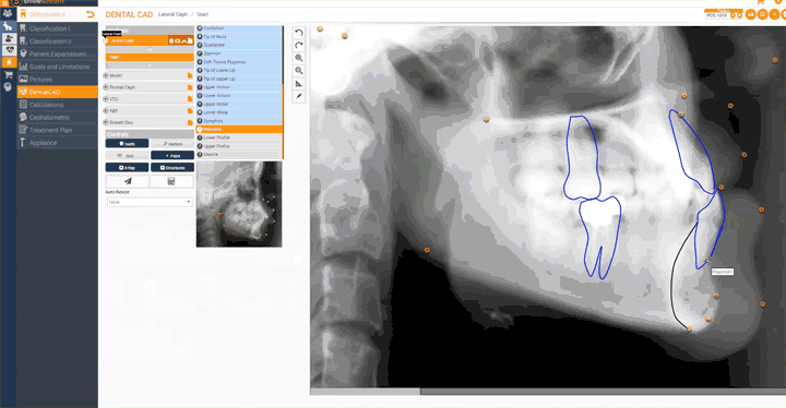 How to Easily Navigate Your Orthodontic Treatment Plans with ...