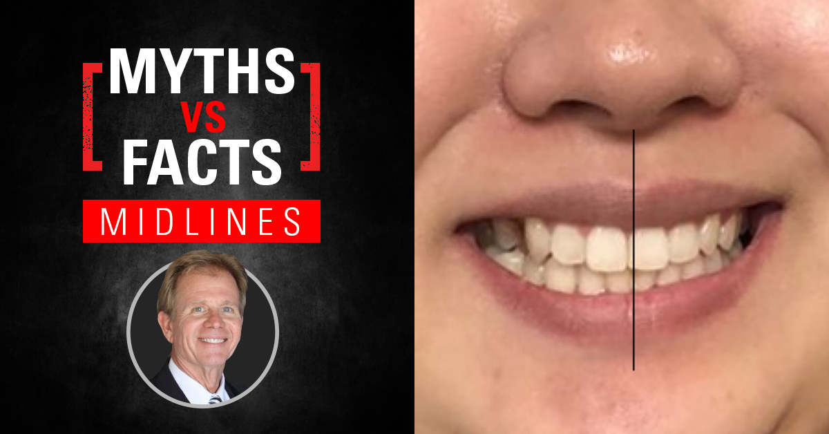 Myths & Facts About Midlines in Orthodontics | Dr. Jeffery Taylor sets ...