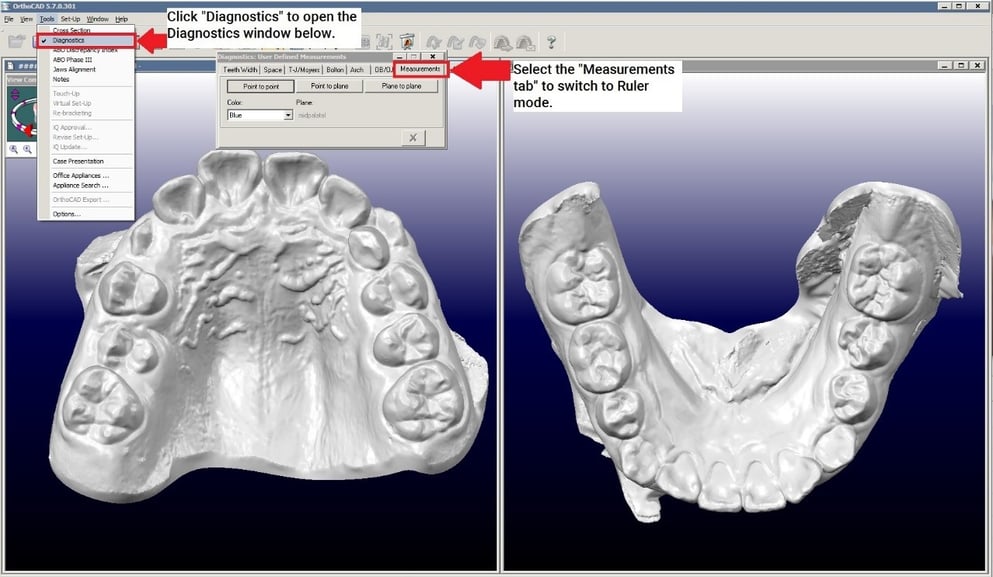 How to Use Your iTero Intraoral Scans in SmileStream