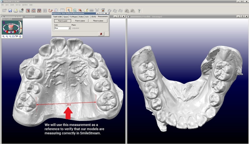 How to Use Your iTero Intraoral Scans in SmileStream