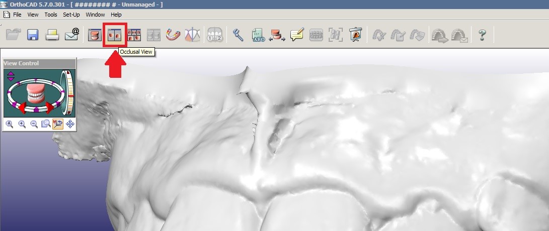 How to Use Your iTero Intraoral Scans in SmileStream