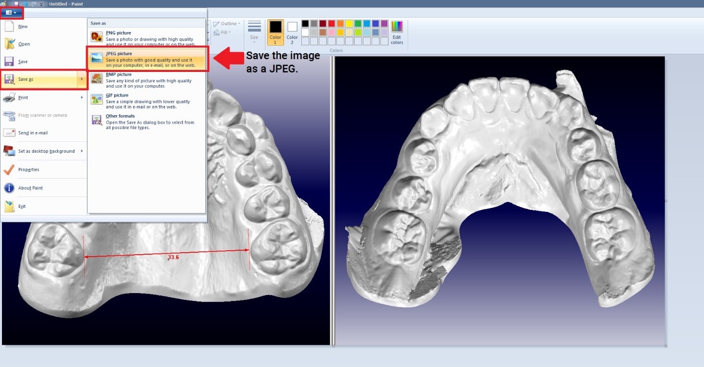How to Use Your iTero Intraoral Scans in SmileStream