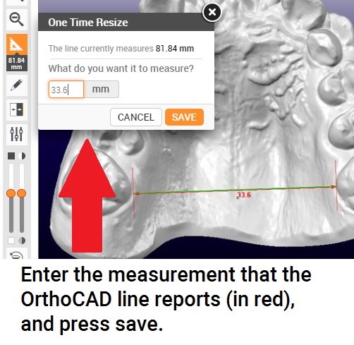 How to Use Your iTero Intraoral Scans in SmileStream