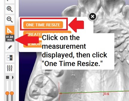 How to Use Your iTero Intraoral Scans in SmileStream