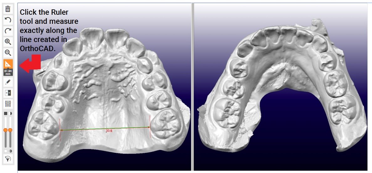How to Use Your iTero Intraoral Scans in SmileStream