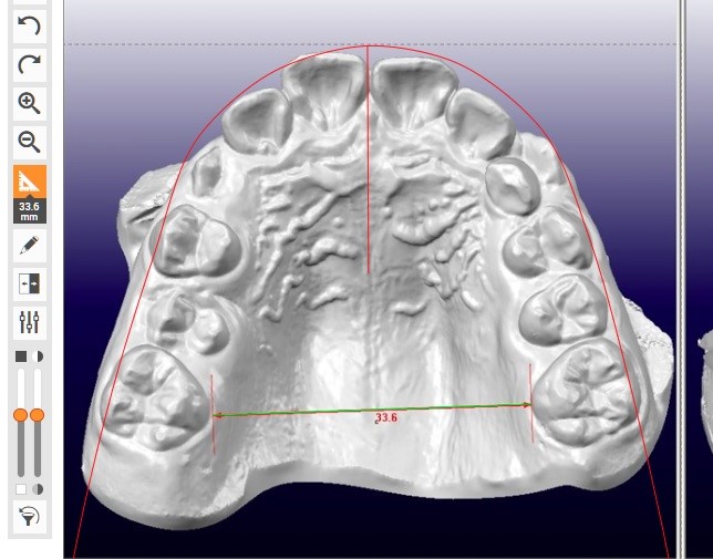 How to Use Your iTero Intraoral Scans in SmileStream