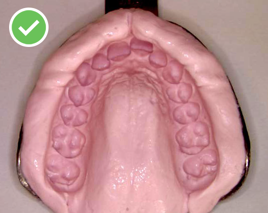 Improve Your Digital Orthodontic Models with These 4 Easy Tips