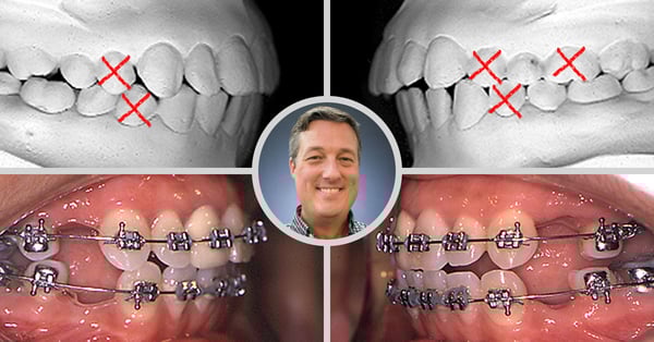 Dr. Shockley Wier's 3-Step Guide to Improve Your Orthodontic Extraction ...