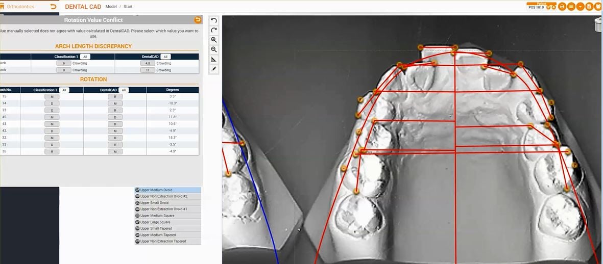 Higher accuracy in digital models discovered yesterday