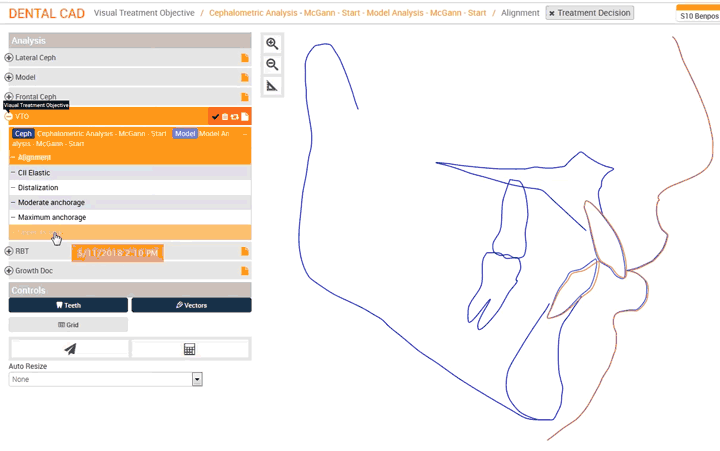 How to Easily Navigate Your Orthodontic Treatment Plans with ...