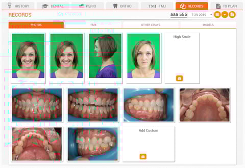 Start Orthodontic Cases in 5 Simple Steps
