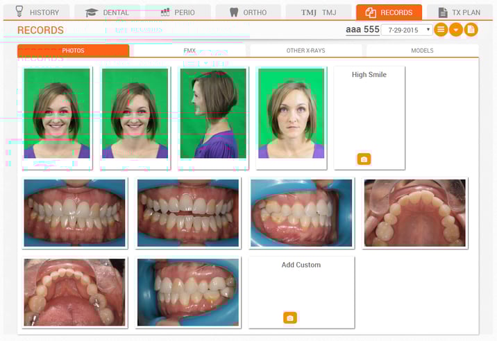 What is the Best Orthodontic Diagnostic Software Tool to Use?